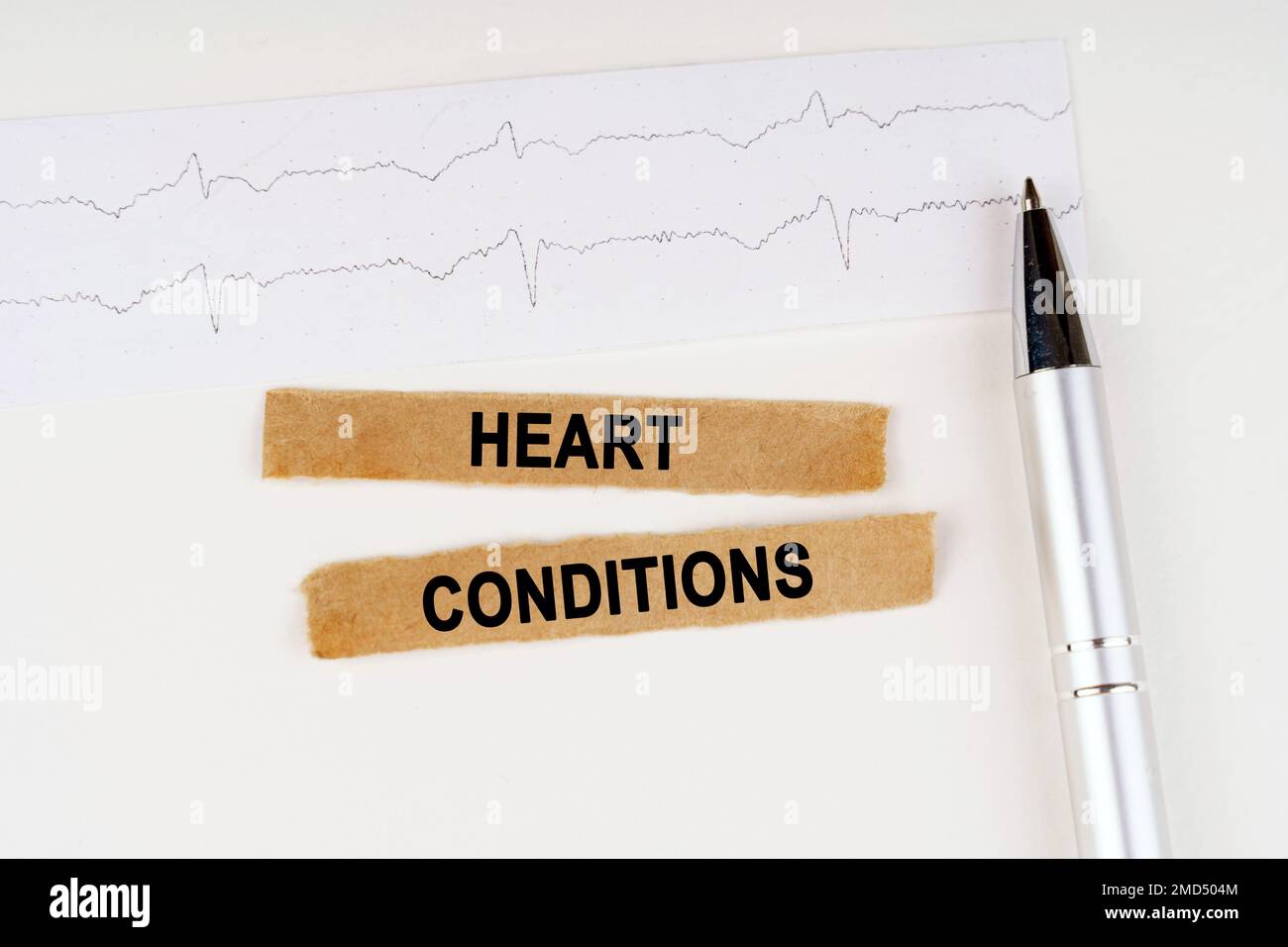 Medical concept. On the cardiogram lies a pen and torn paper with the ...