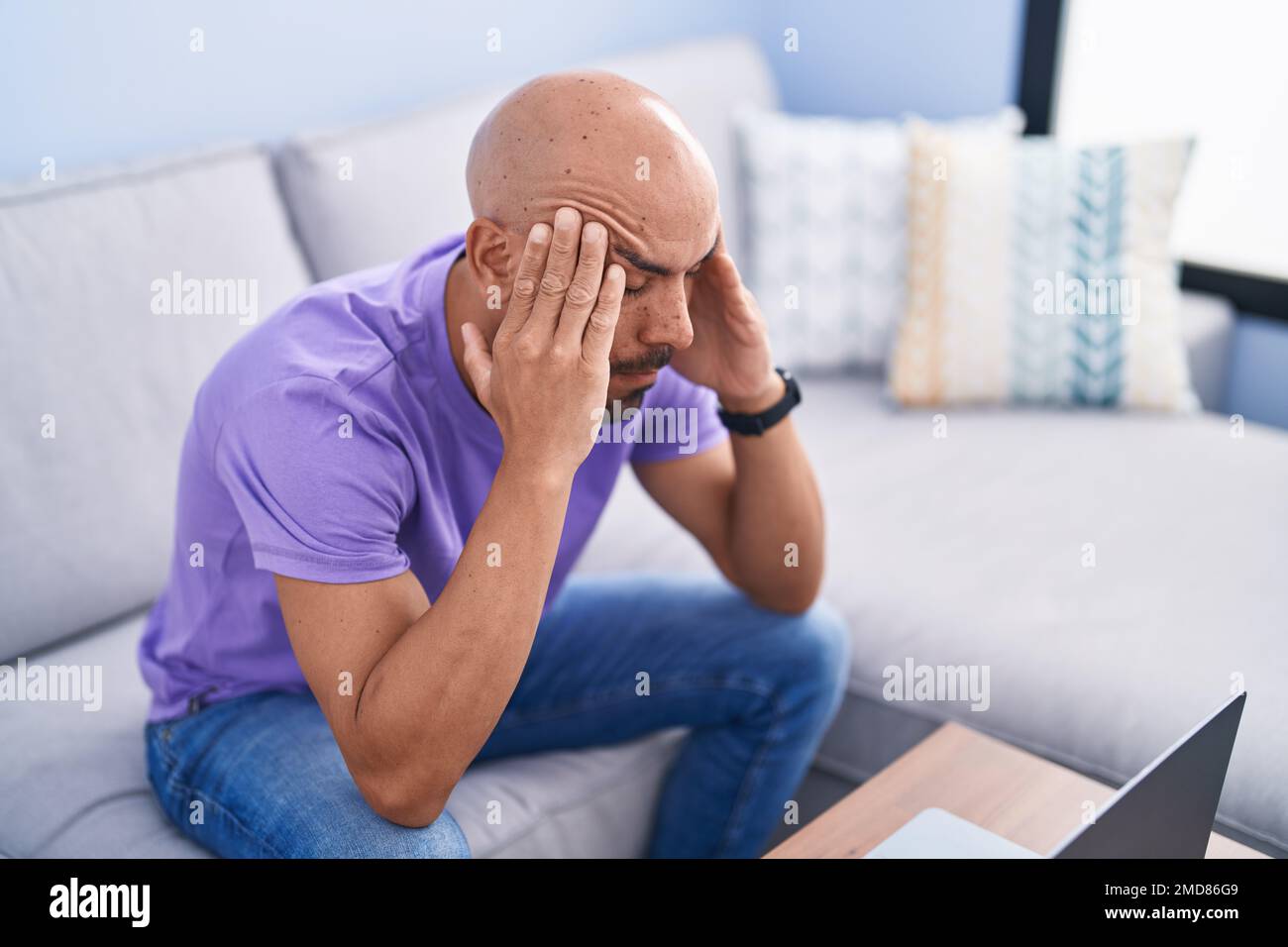 Young bald man stressed sitting on sofa at home Stock Photo - Alamy