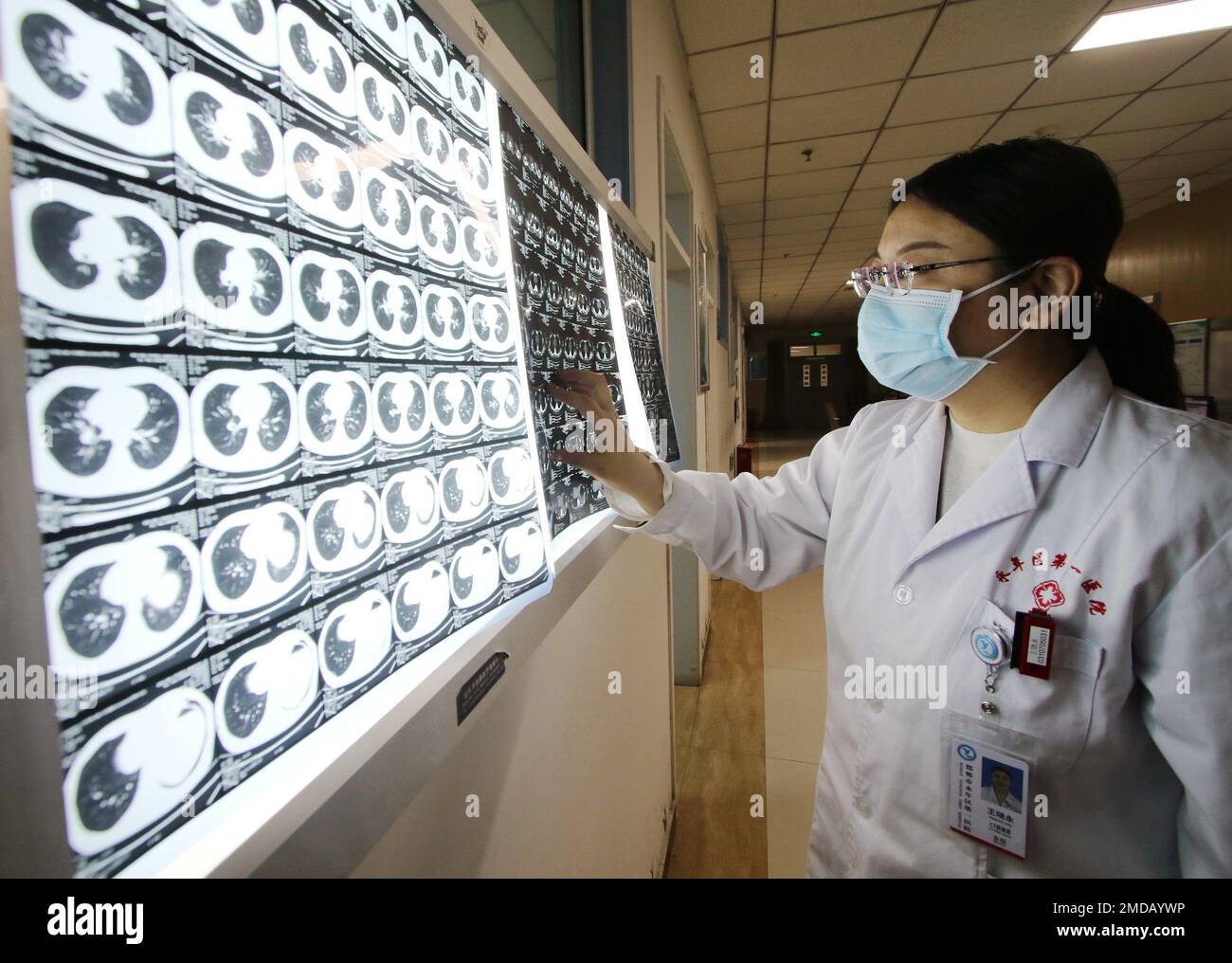 HANDAN, CHINA - JANUAERY 22, 2023 - A doctor looks at a CT image at the ...