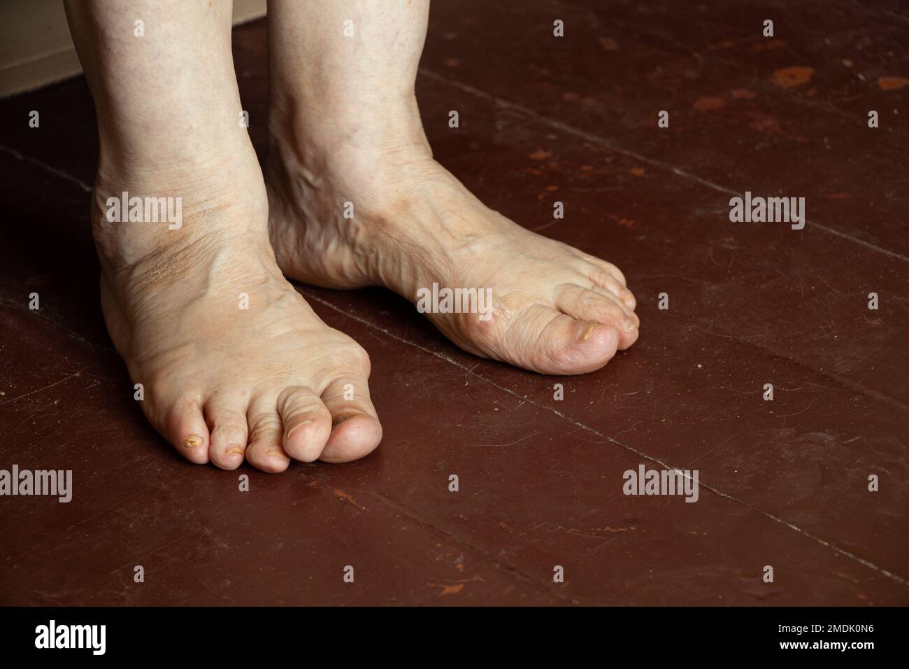 Dirty feet and toes hi-res stock photography and images - Alamy