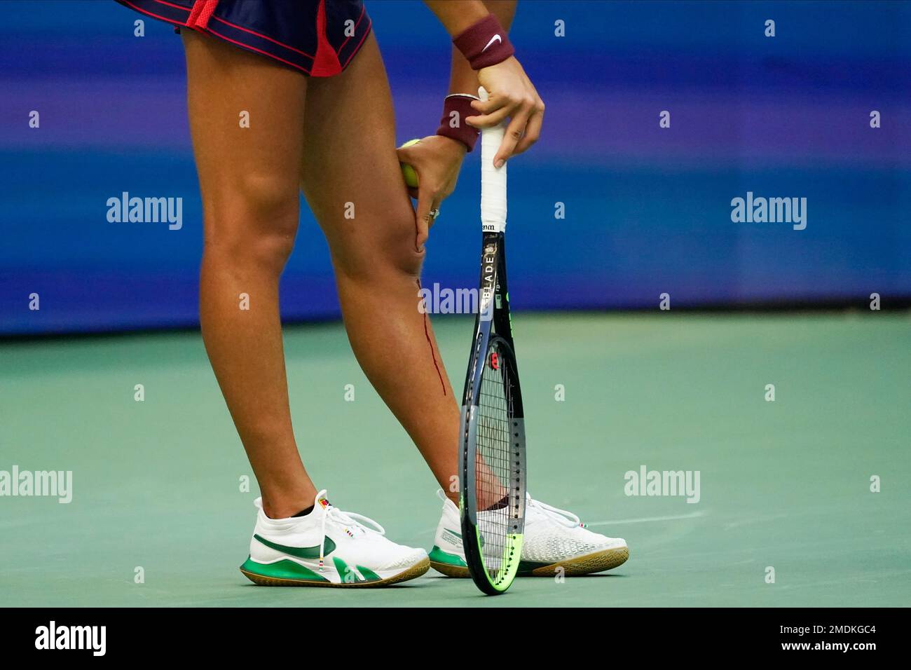 Emma Raducanu, of Britain, checks a cut on her leg after a rally ...