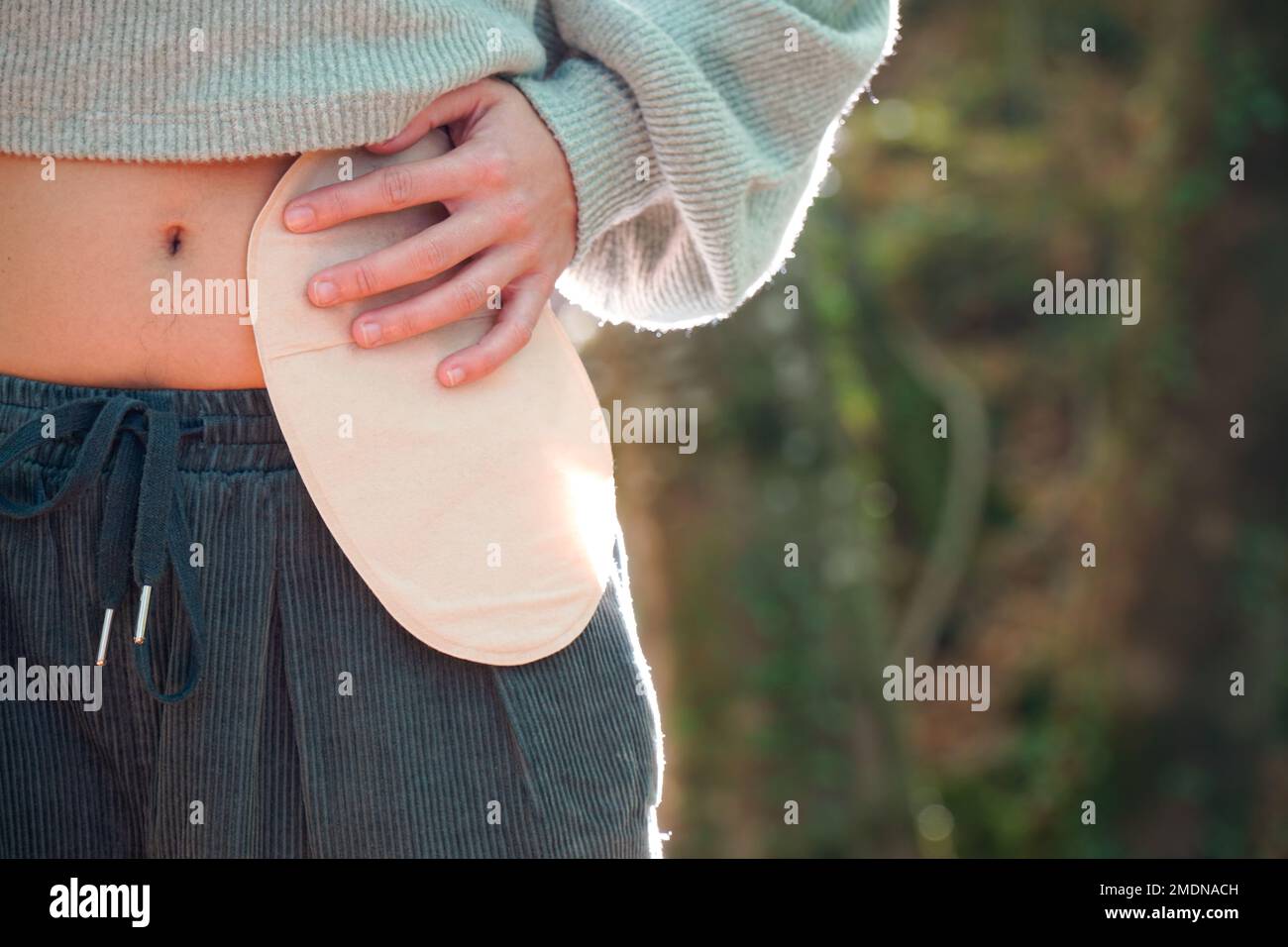 woman in nature showing an ostomy bag. Lifestyle with a colon cancer ...