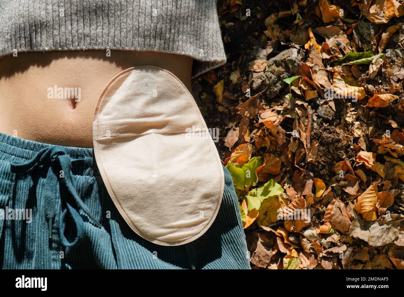 abdomen in nature with an ostomy bag Stock Photo - Alamy