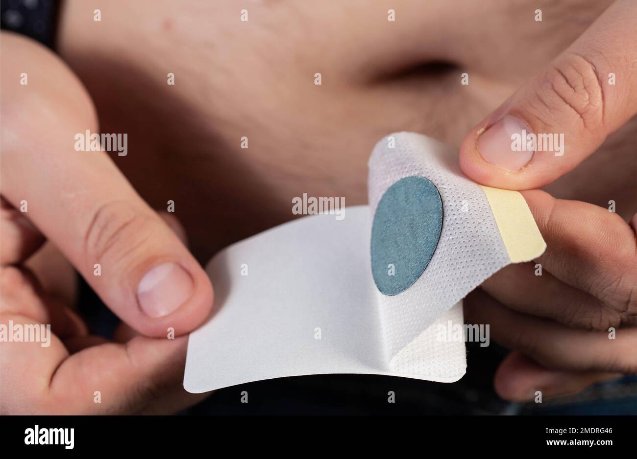 A modern medical patch for prostatitis and urinary tract infections. A ...