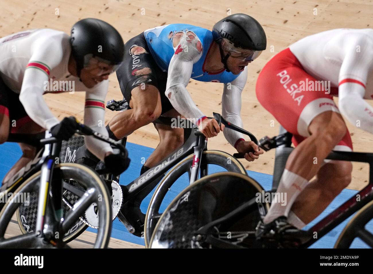 Hugo Barrette of Team Canada shows wounds from a crash as he competes ...