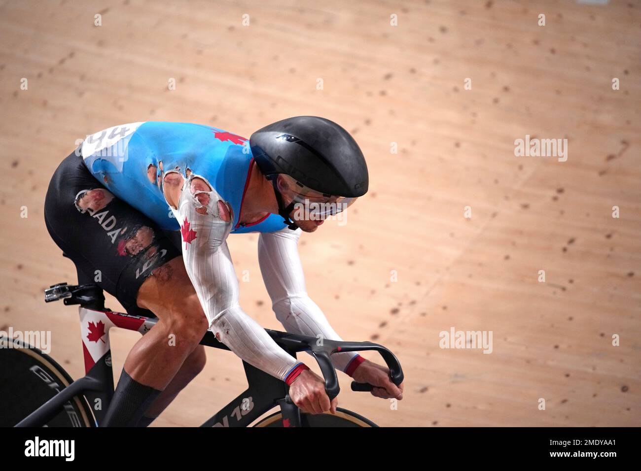 Hugo Barrette of Team Canada shows wounds from a crash as he competes ...