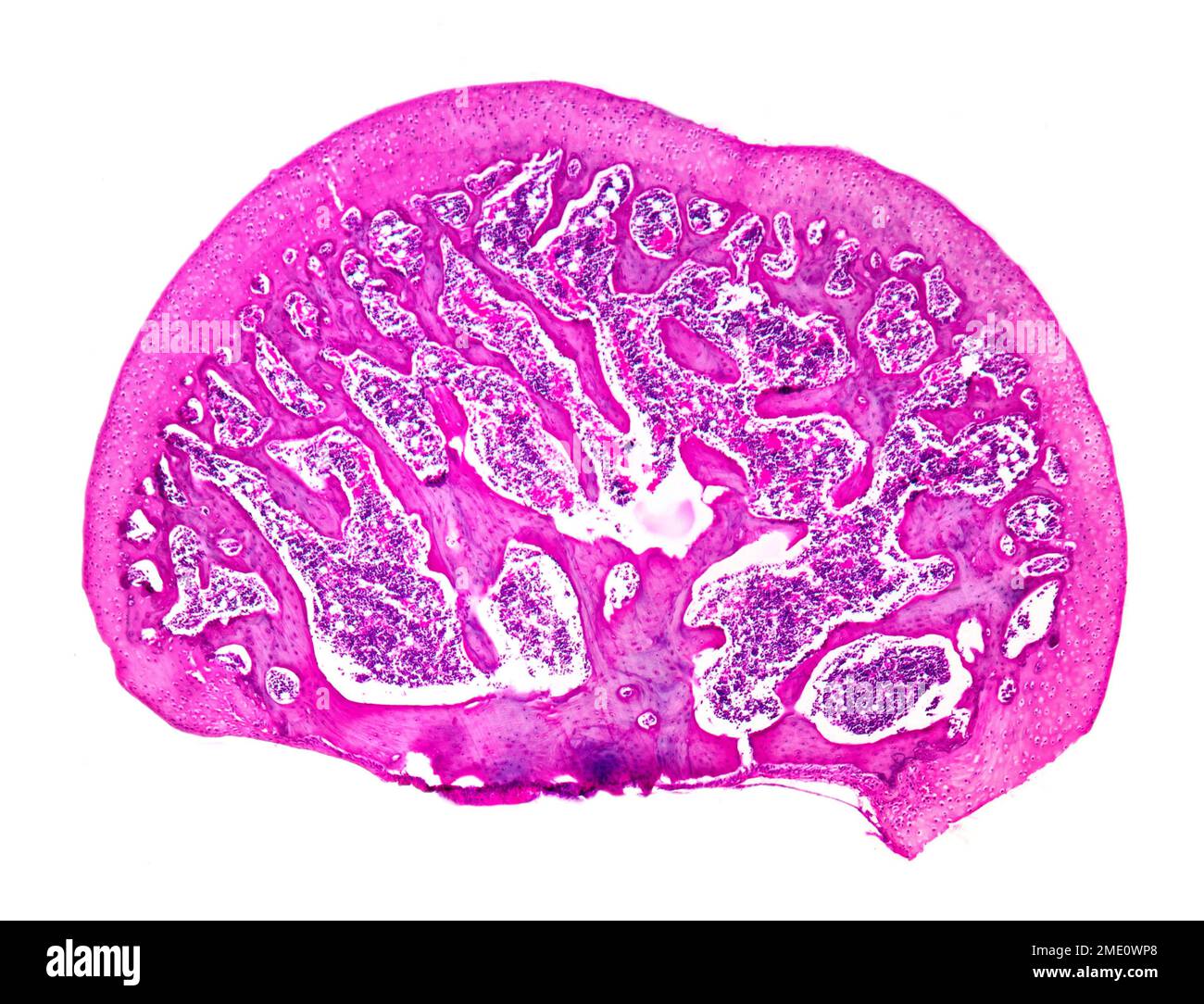 Bone stained section, mammal, femur, brightfield photomicrograph Stock ...