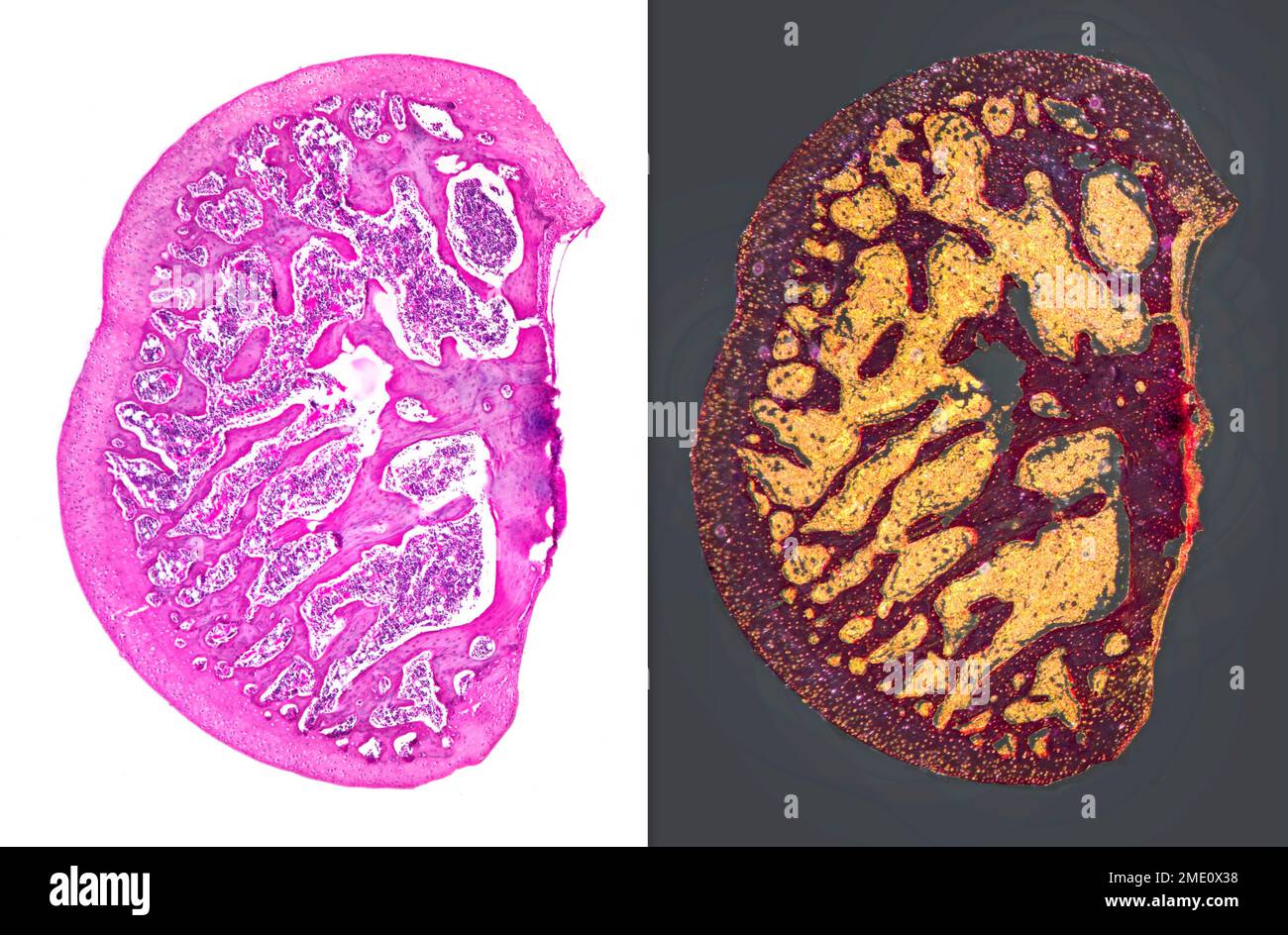 Bone stained section, mammal, femur. Brightfield & darkfield image ...