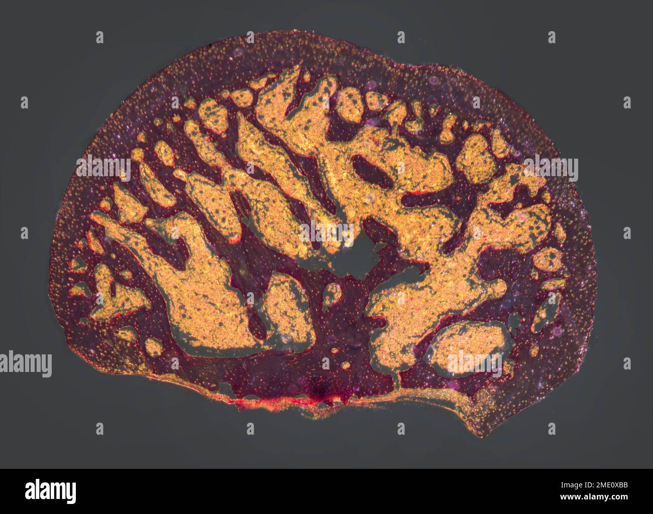 Bone stained section, mammal, femur, darkfield image Stock Photo - Alamy