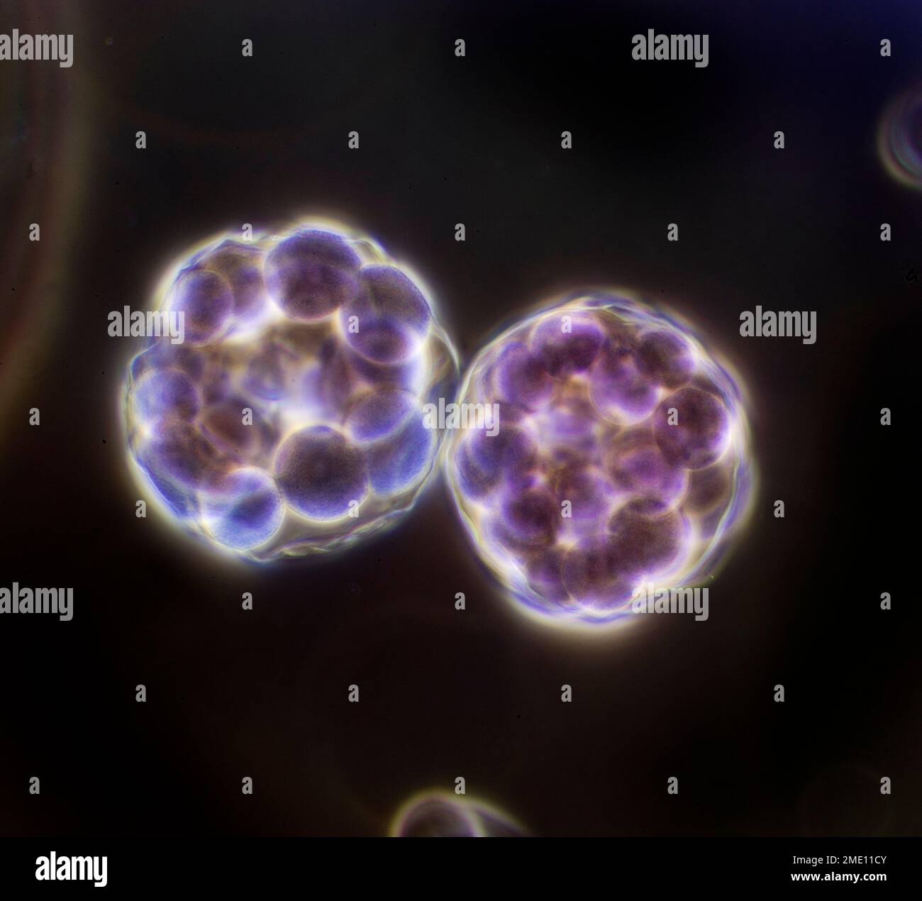 Starfish emryo development stages Stock Photo - Alamy