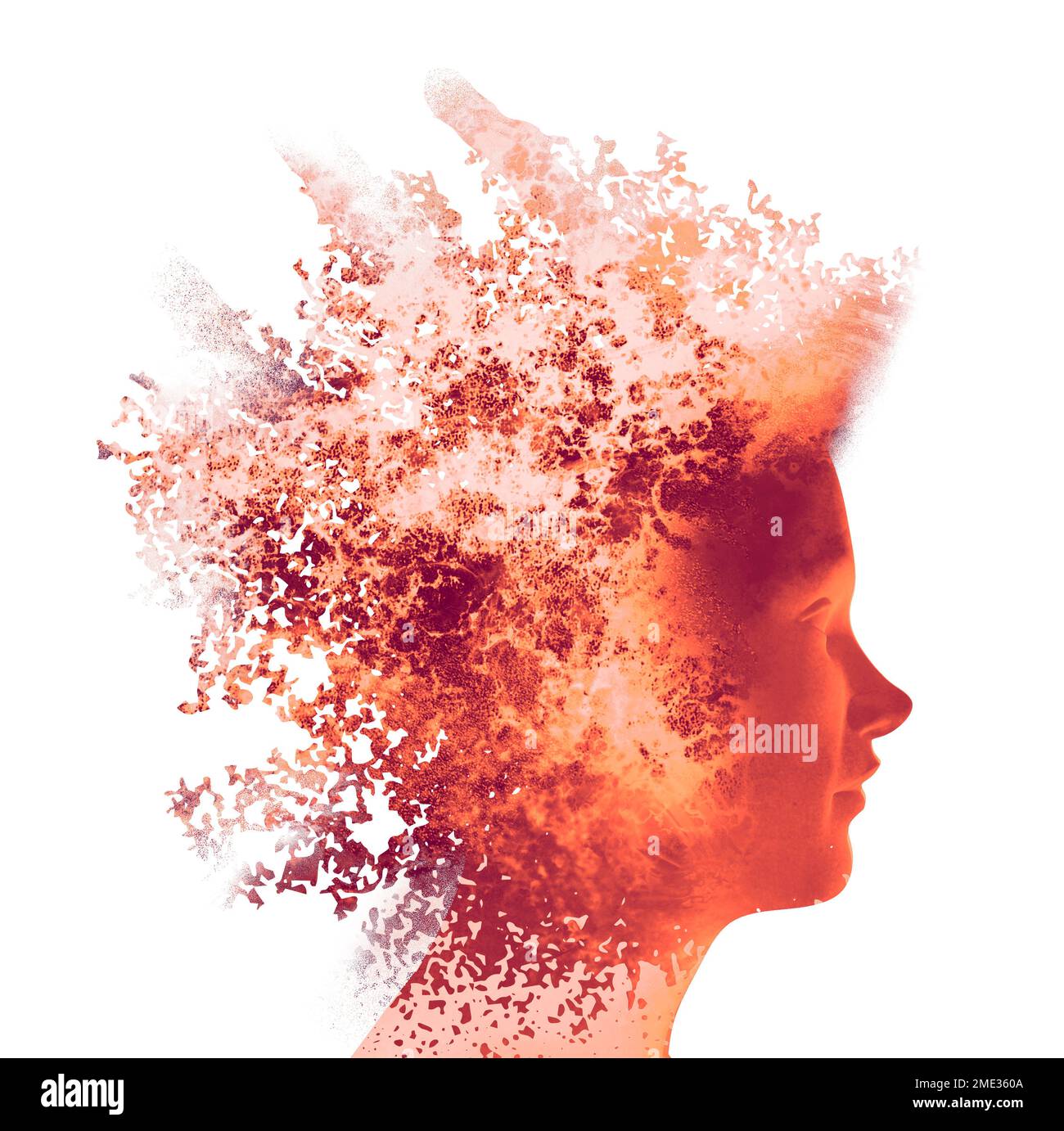 Face seen from the side. Brain problems. Degenerative disease. Bipolar ...