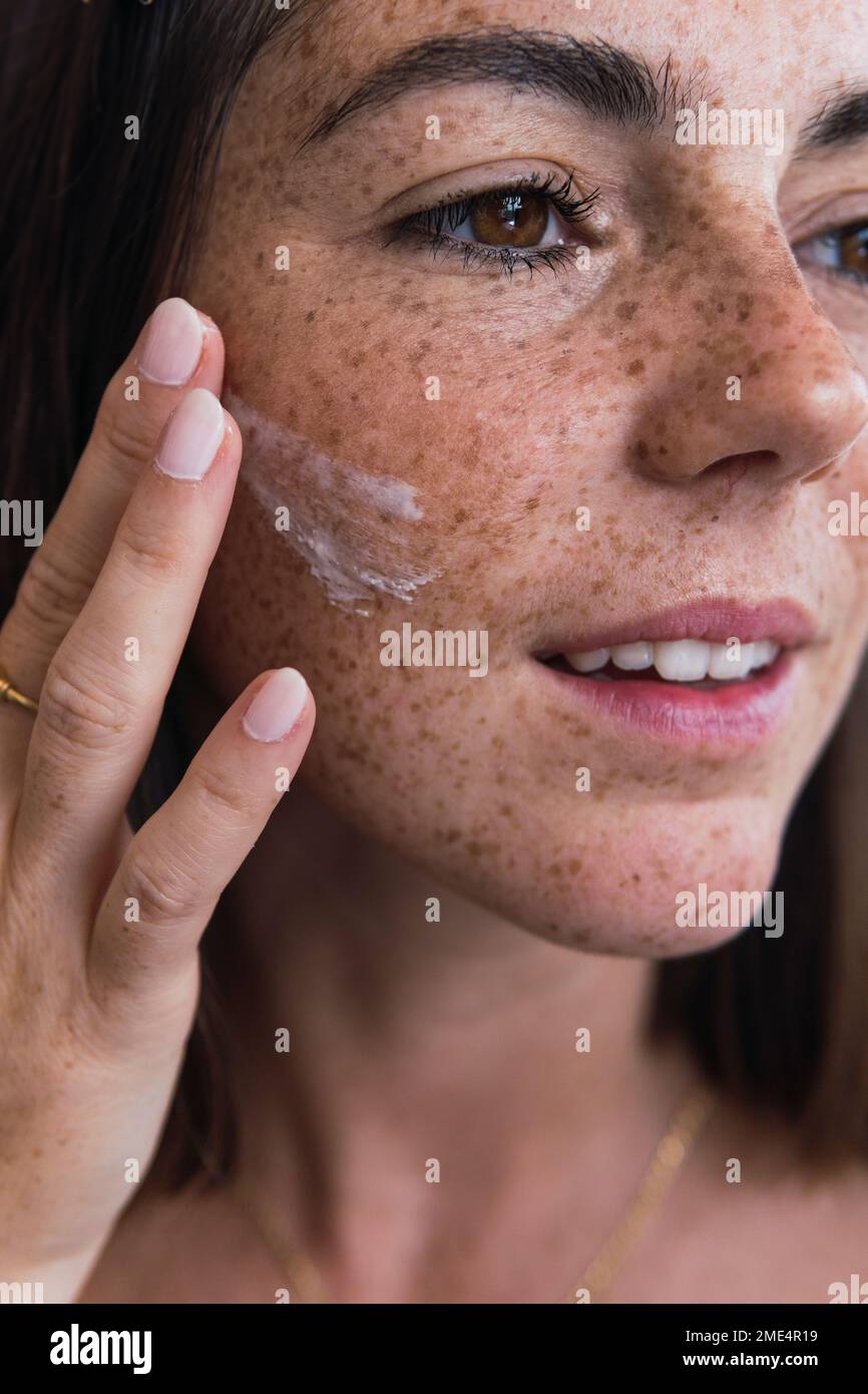 Freckle face hi-res stock photography and images - Alamy