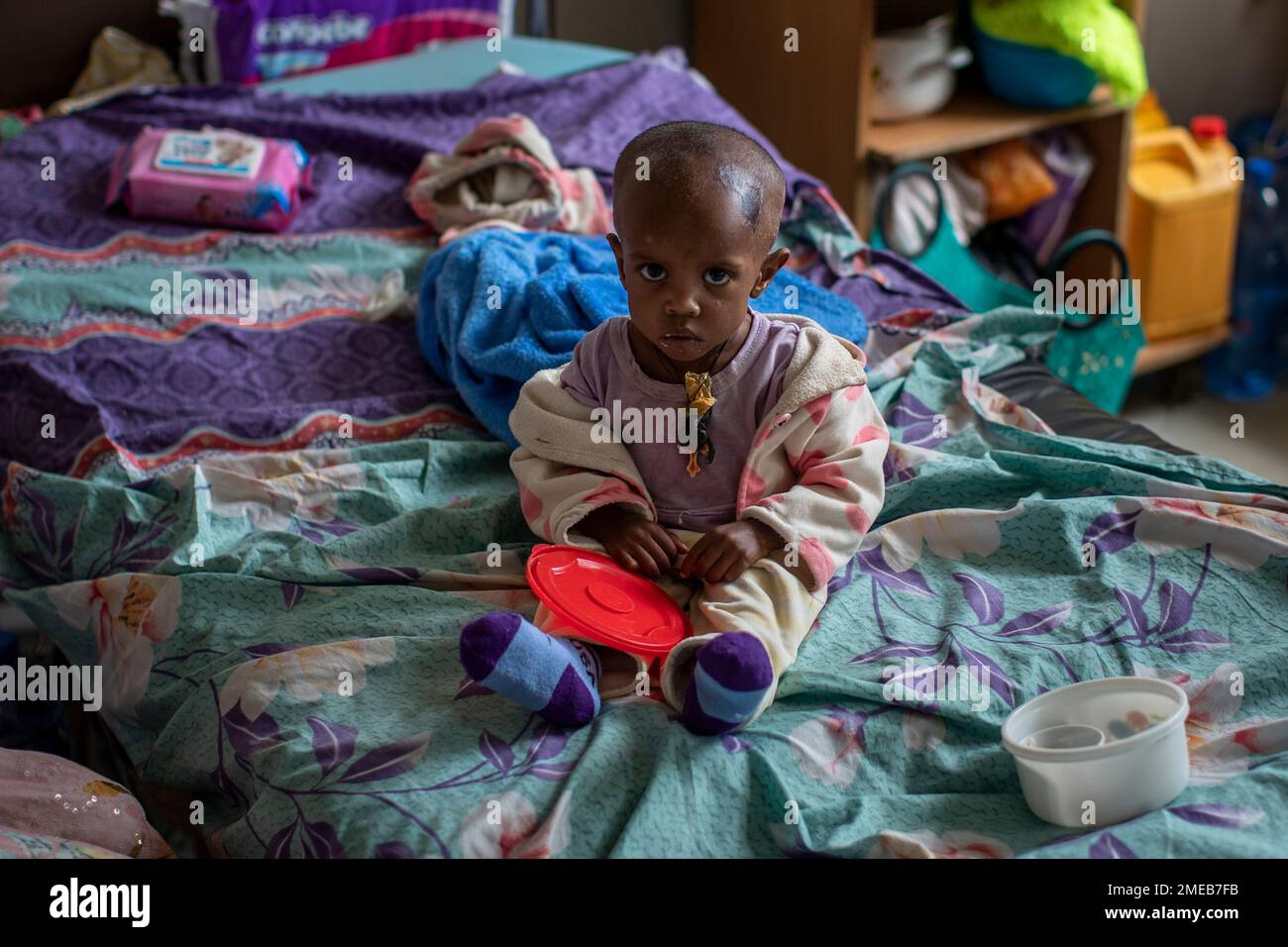 Tekien Tadese, 25, holds her baby, Amanuel Mulu, 22 months old, who is ...