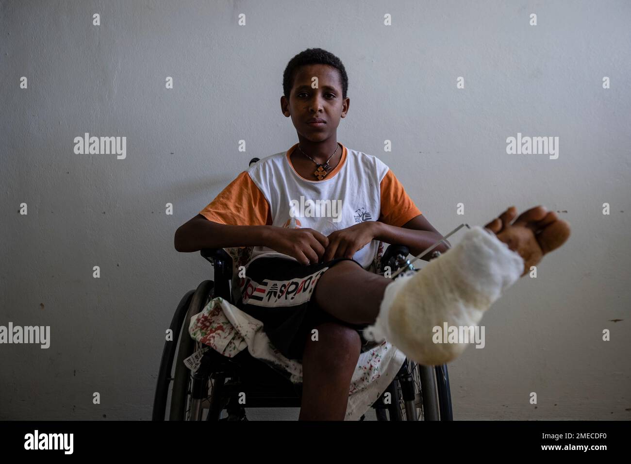 Desalegn Gebreselassie, 15, whose foot was injured when a grenade ...