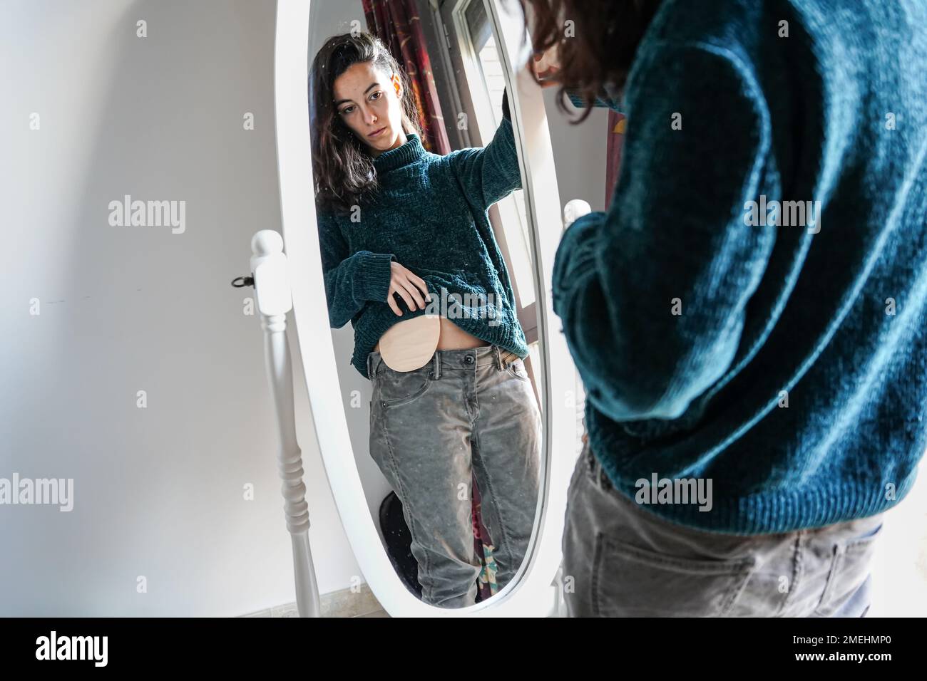 young woman with an ostomy bag on her belly looks in the mirror at home ...