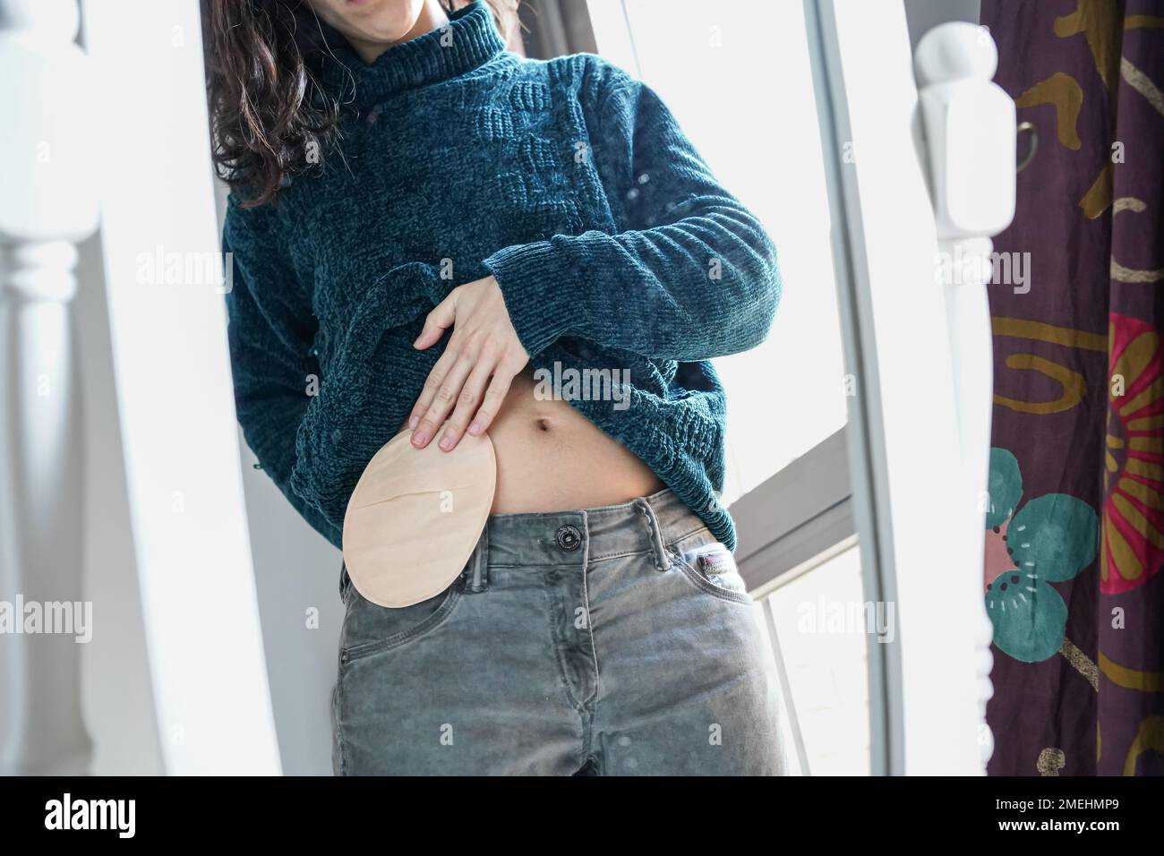 young woman with an ostomy bag looks in the mirror at home. Self-esteem ...