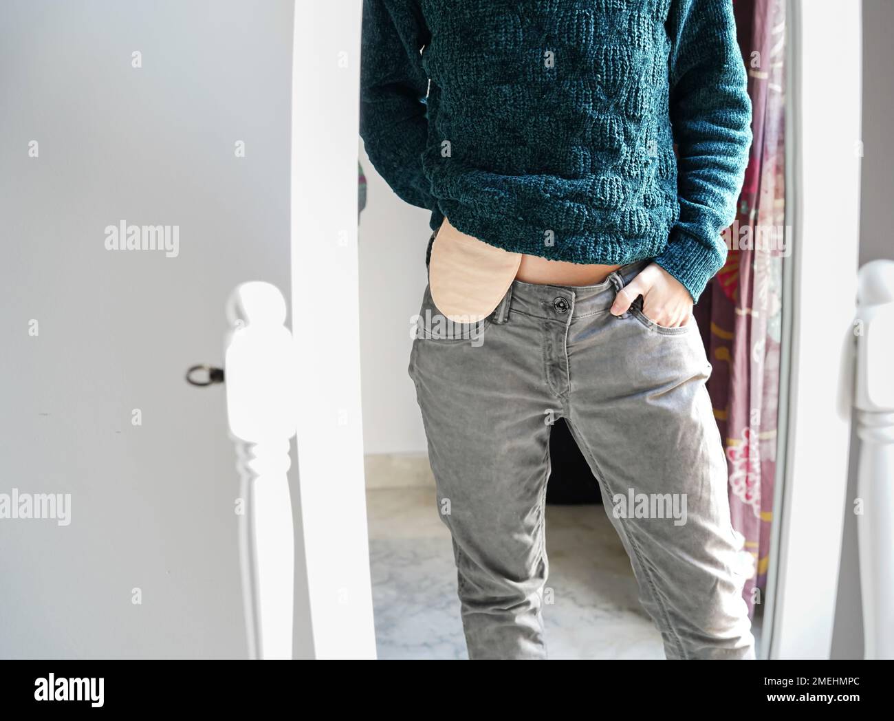 A woman looks at her ostomy bag in her bedroom mirror. resilience after ...