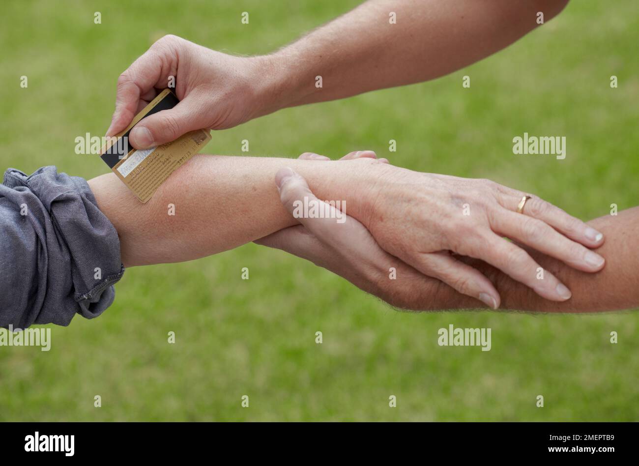 Removing insect sting using credit card Stock Photo - Alamy