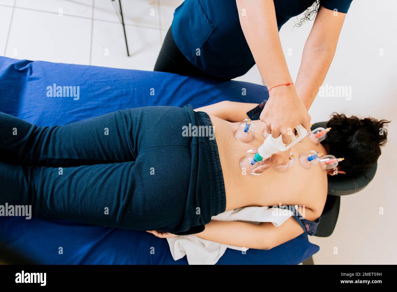 Physiotherapist placing cupping on lying female patient. Modern ...