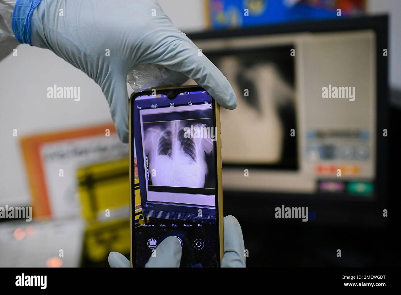 A health worker takes a photo of a COVID-19 patient's chest X-rays with ...