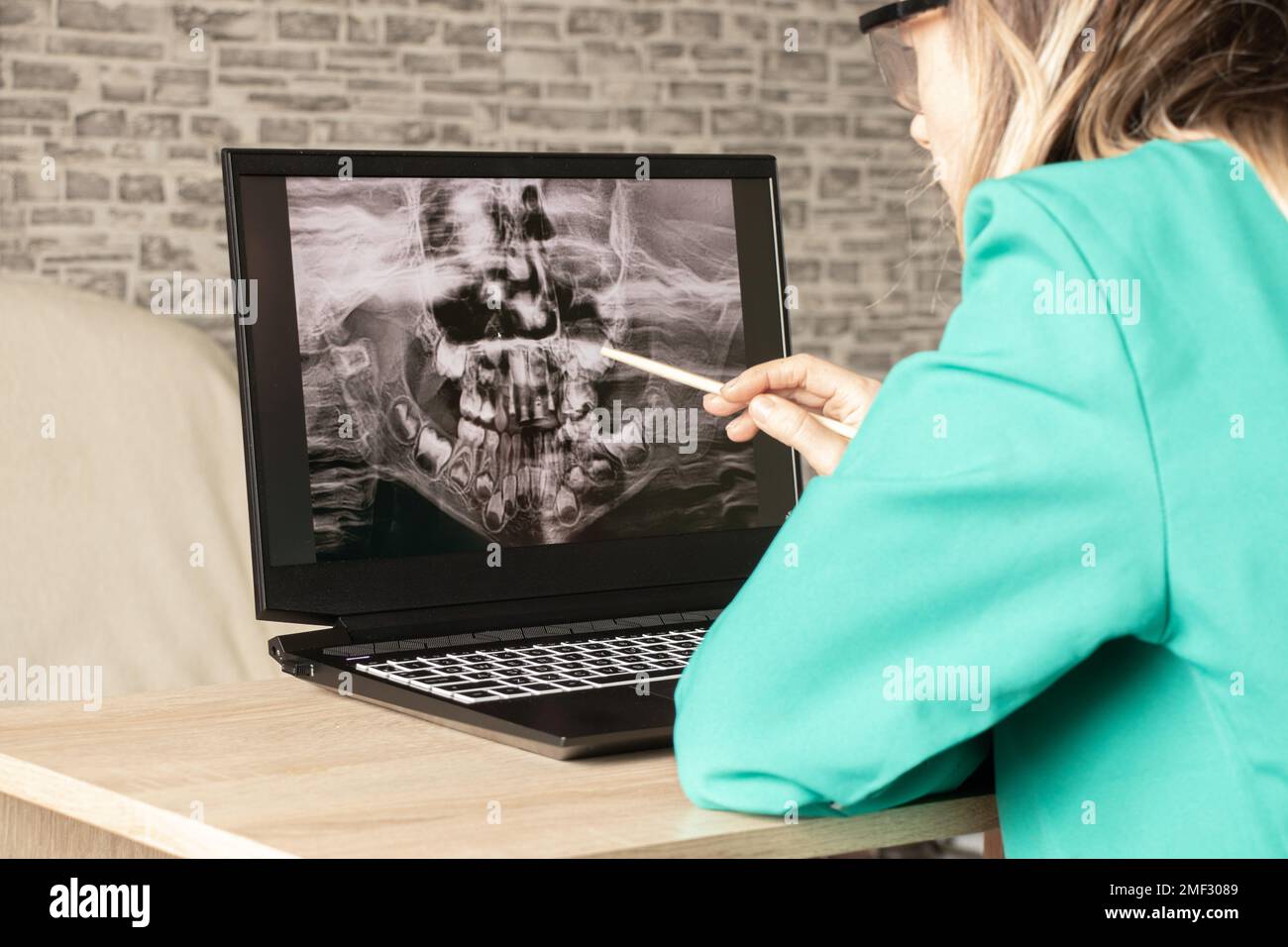 panoramic X-ray of children's teeth of two jaws, orthopantomogram of ...