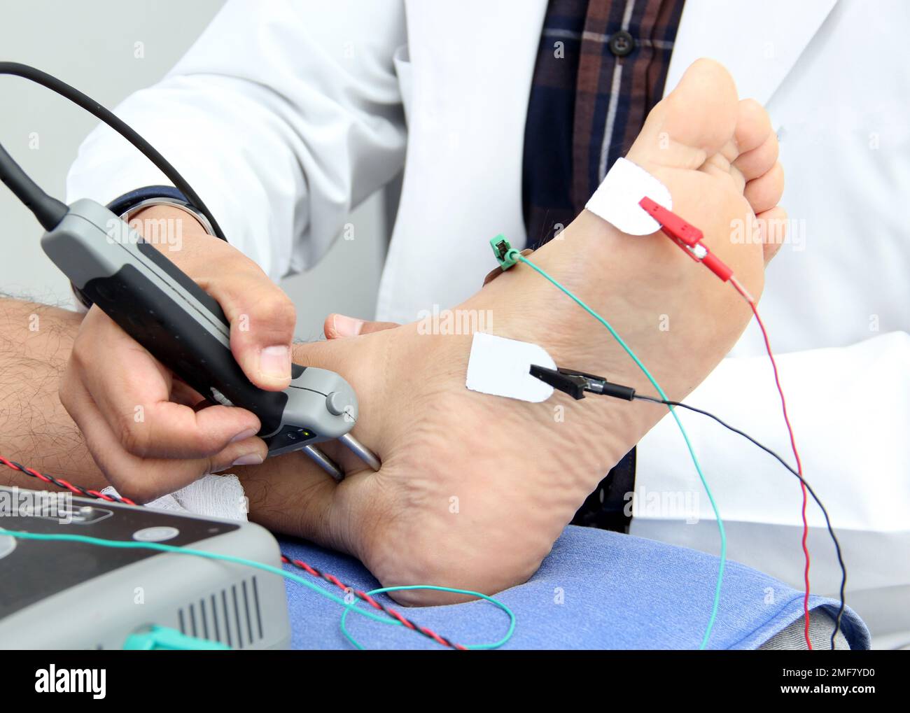 Somatosensory Evoked Potentials (SEP) or Nerve Conduction Velocity (NCV ...