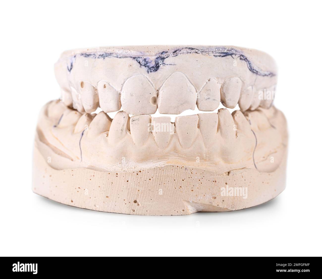 The cast of the jaw of the teeth from plaster isolated on white Stock ...