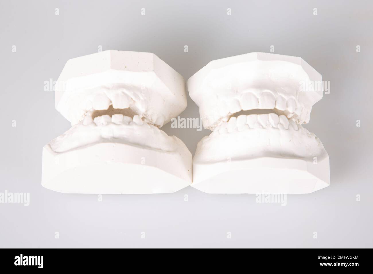 Denture white gypsum print plaster teeth model on grey background Stock ...