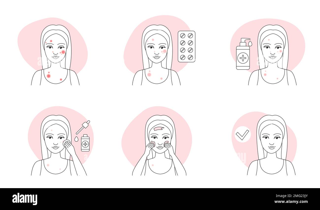 Acne treatment, thin line infographic icons set vector illustration ...