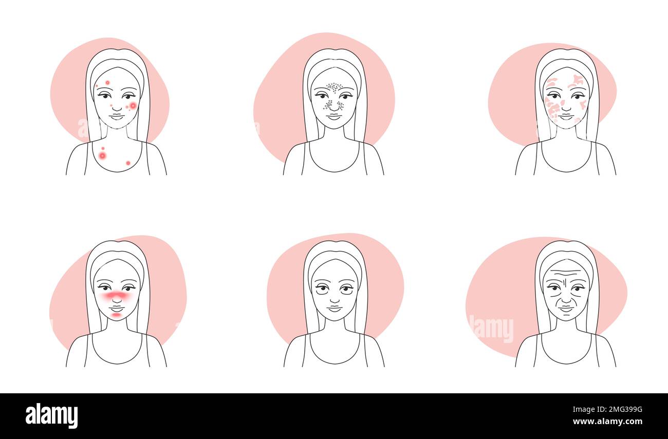 Skin problems line icons set vector illustration. Outline sketches of ...