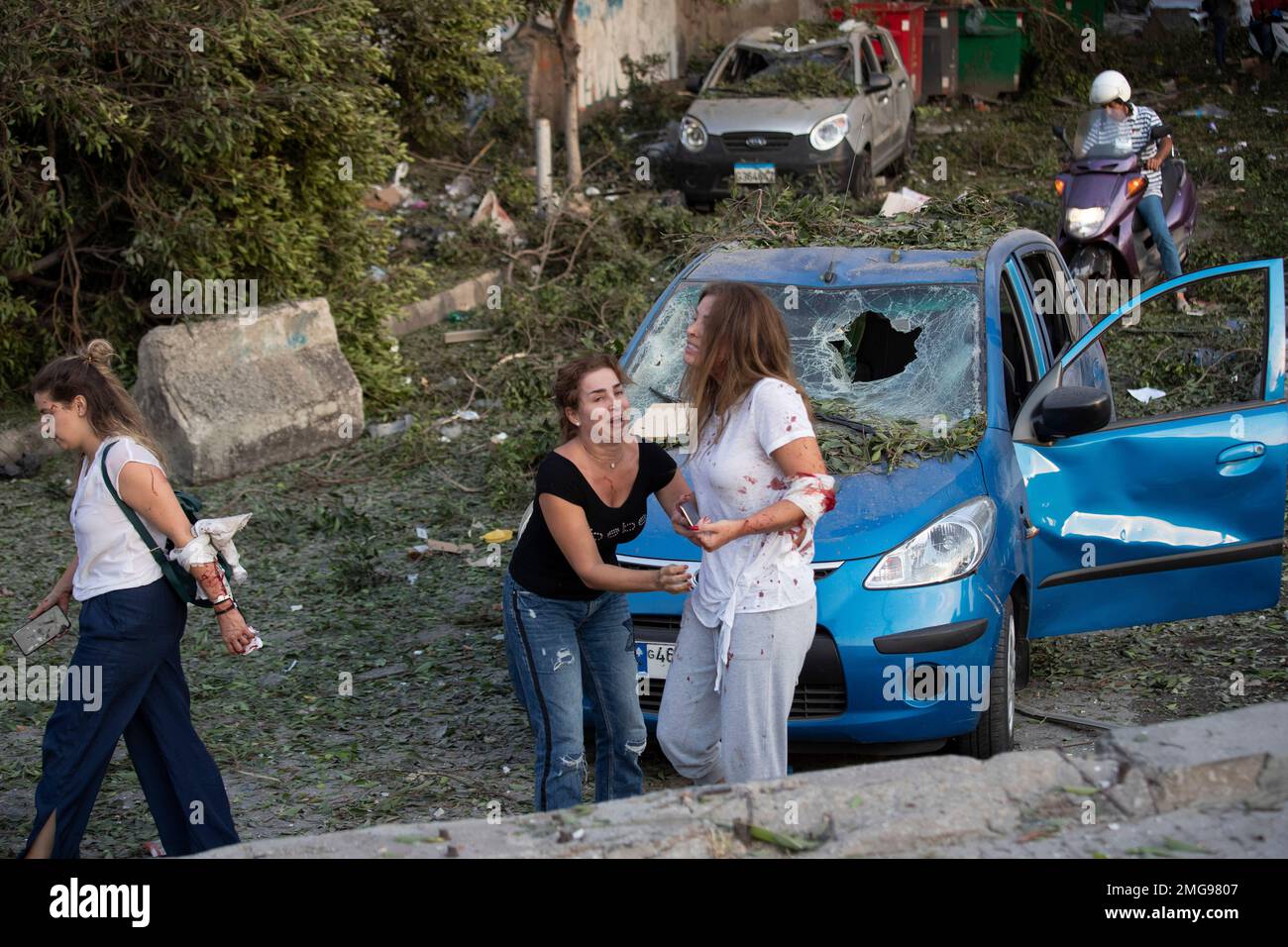 Injured people stand after of a massive explosion in Beirut, Lebanon ...