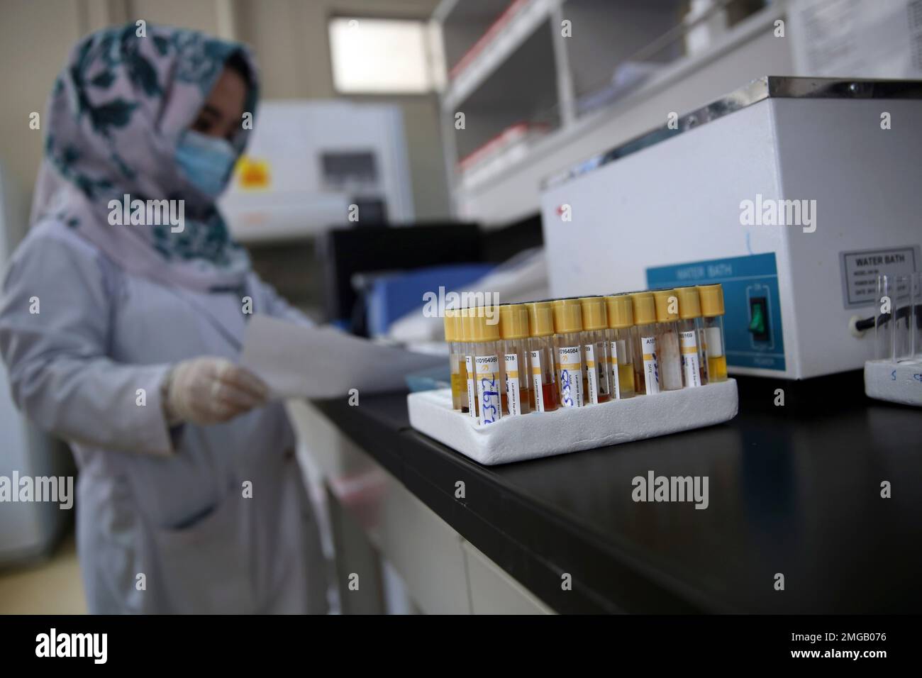 An Afghan lab technician tests samples at the Afghan-Japan Communicable ...