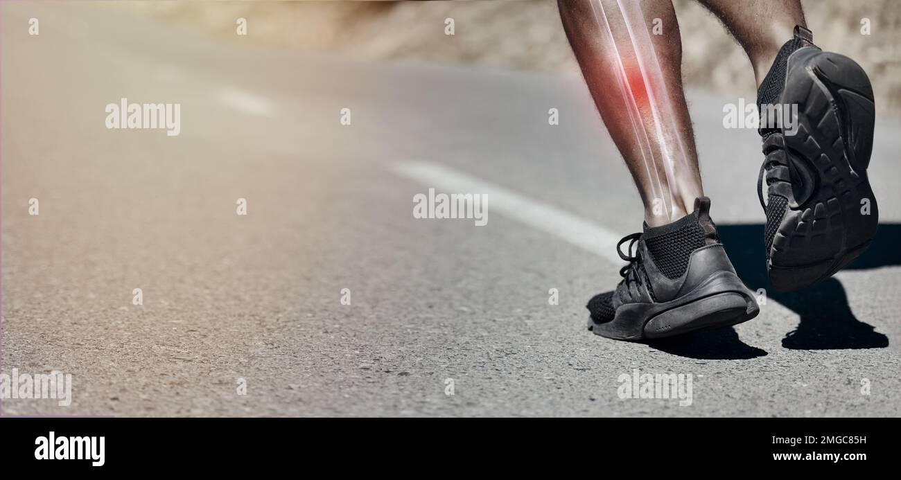 Injury, skeleton and pain of running athlete training, exercise or ...
