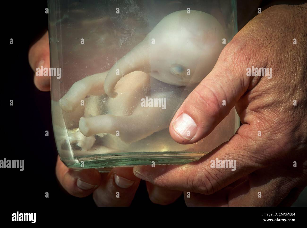 Elephant Embryo Vs Human Embryo