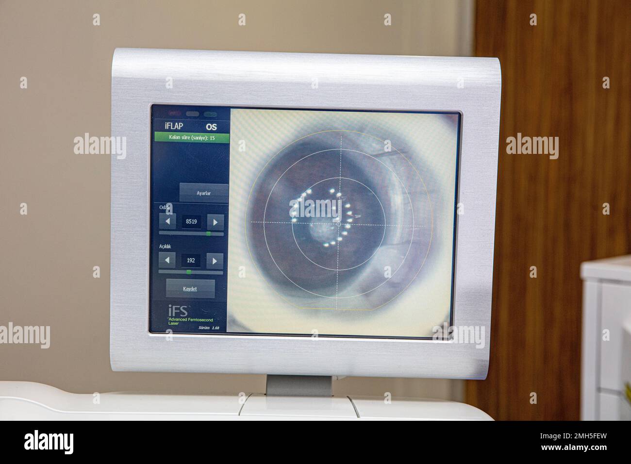 Laser vision correction.Patient and team of surgeons in the operating ...