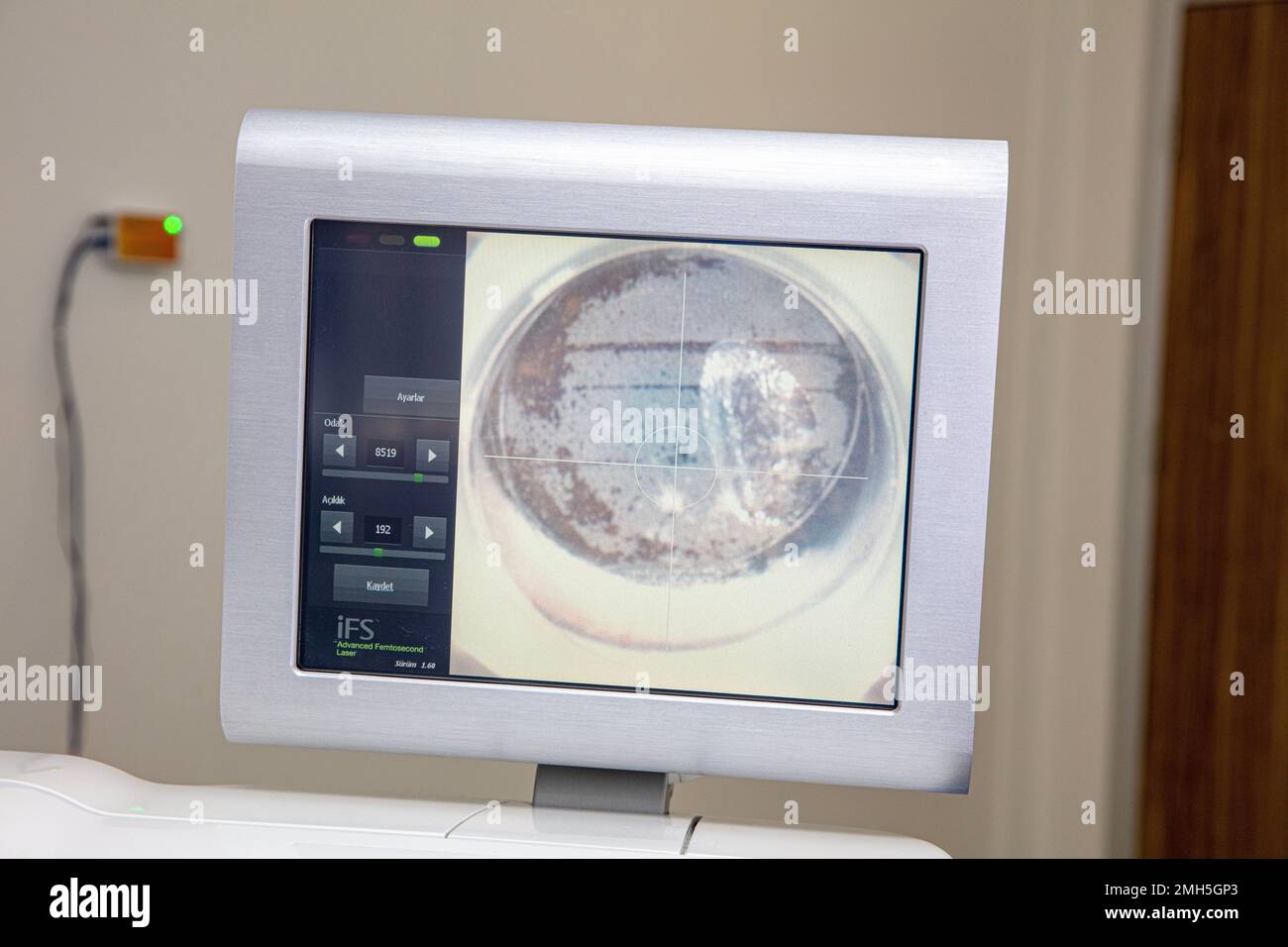 Laser vision correction.Patient and team of surgeons in the operating ...