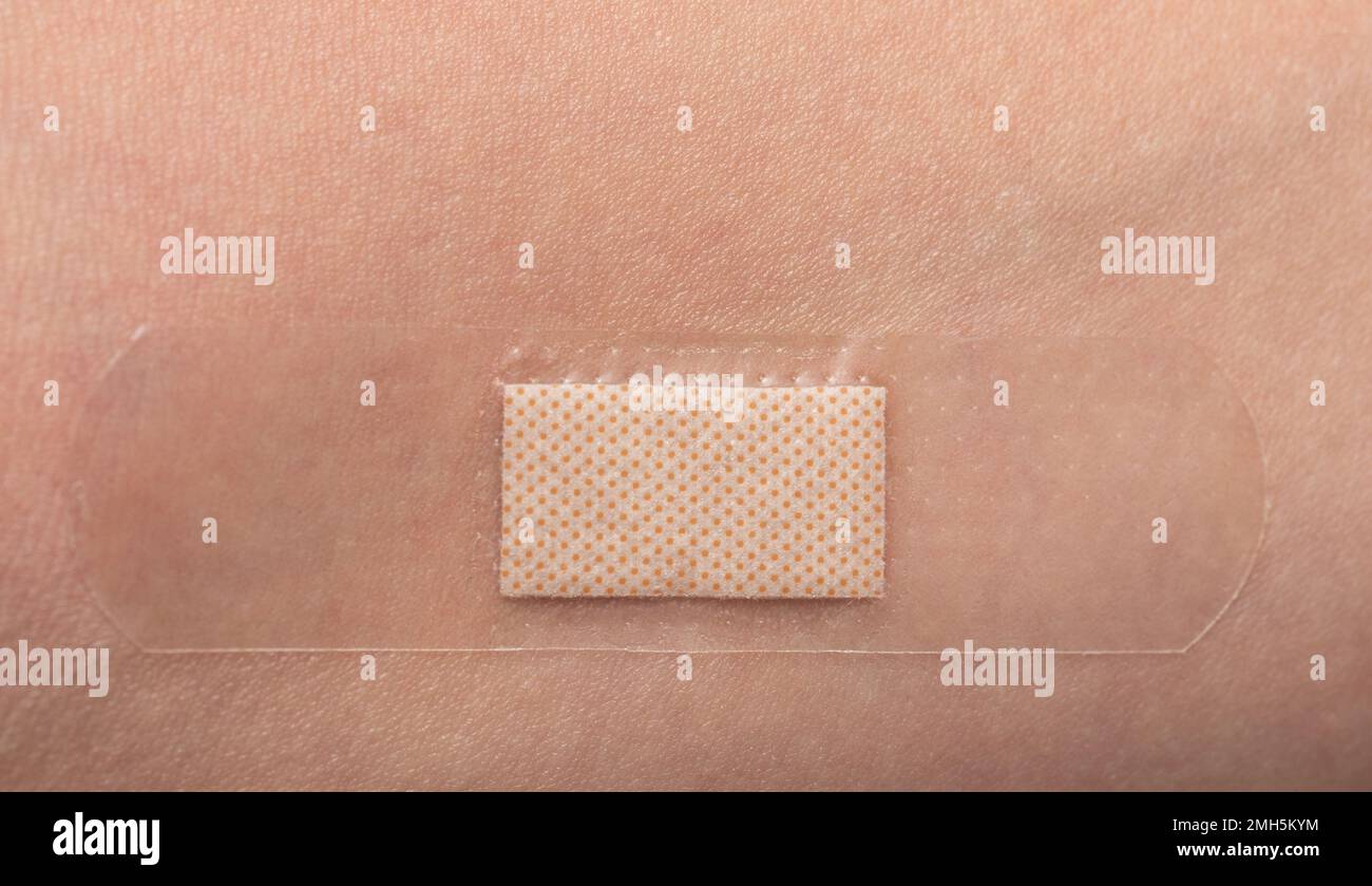 Medical band on skin scar macro close up view Stock Photo - Alamy