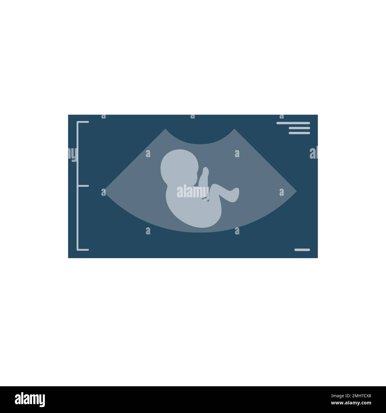 Ultra sound fetus unborn child icon. Simple illustration of ultra sound ...