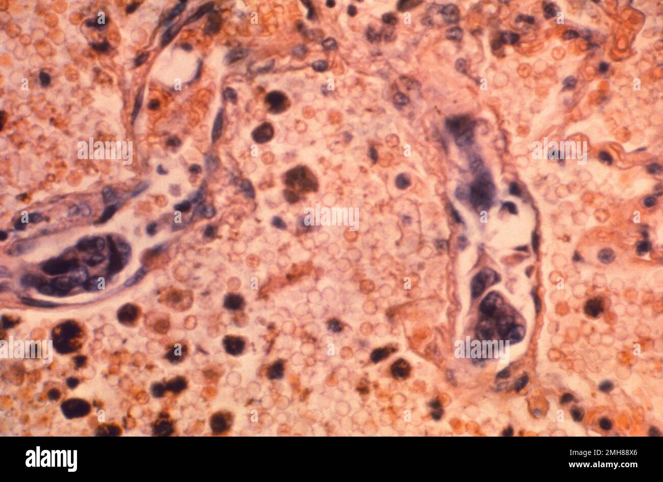 This 1964 microscope photo made available by the Centers for Disease ...