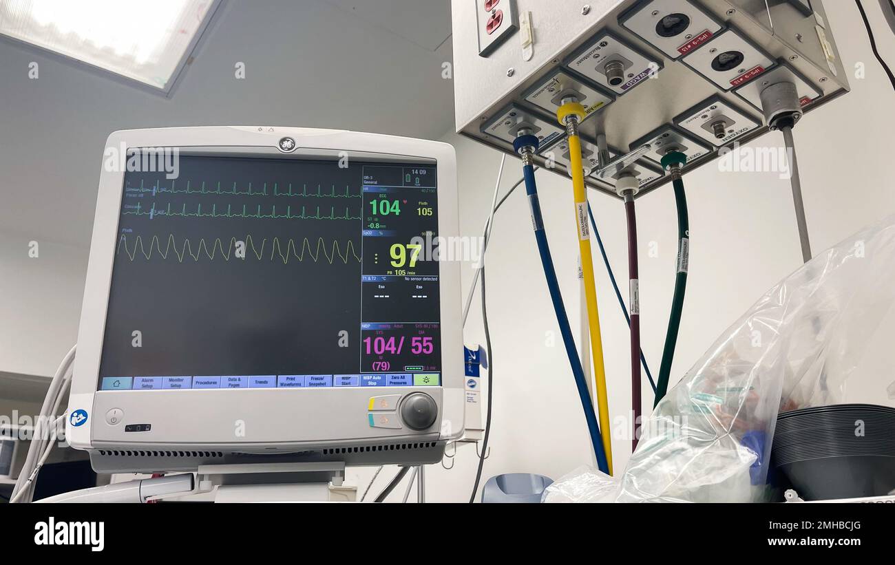 Cardiogram monitor ekg operation hi-res stock photography and images ...