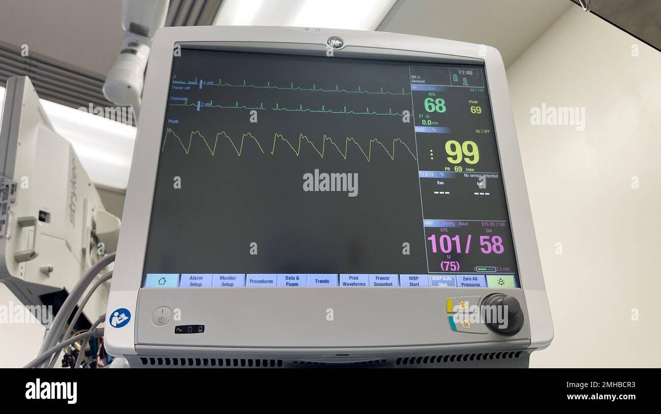 Hospital Monitors anesthesia machine blood pressure oxygen level heart ...