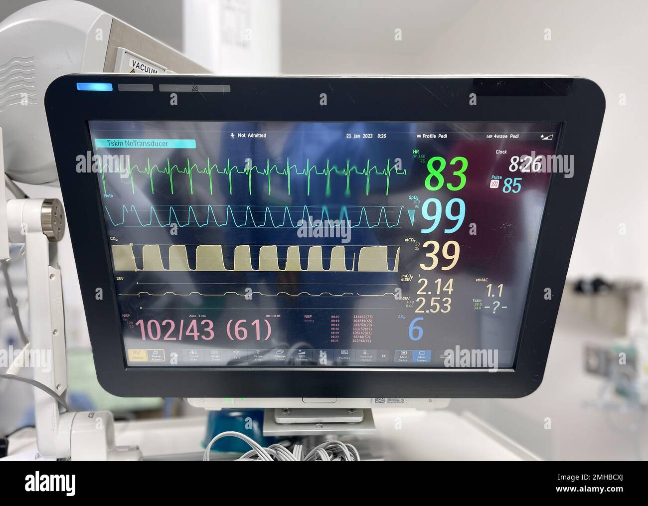 Hospital Monitors anesthesia machine blood pressure oxygen level heart ...