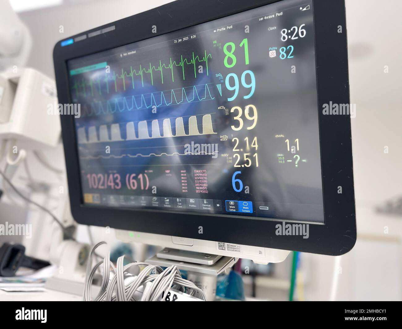 Hospital Monitors anesthesia machine blood pressure oxygen level heart ...