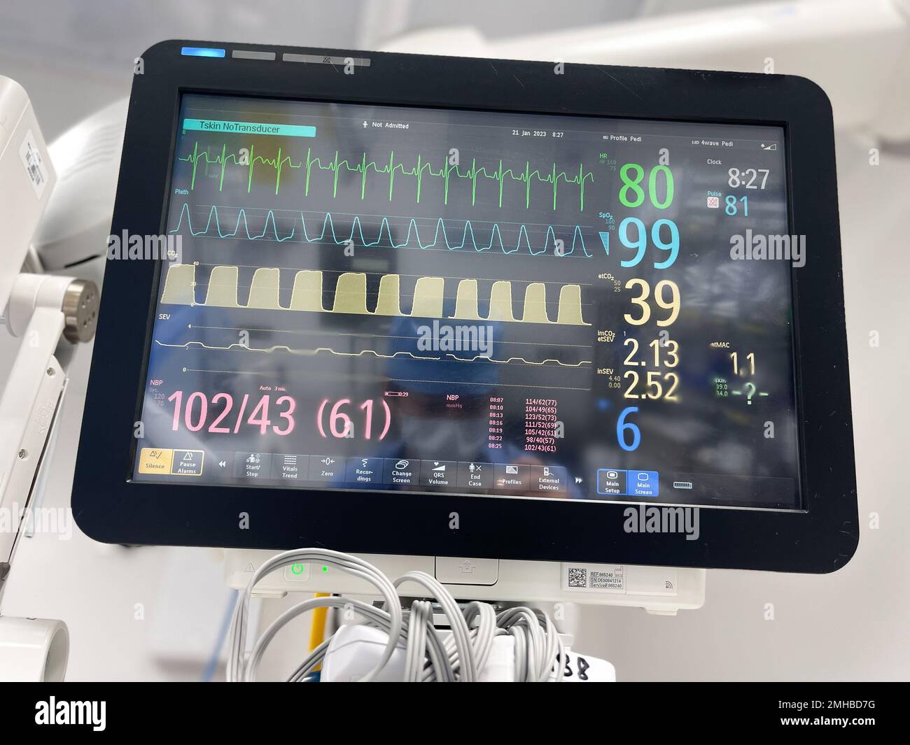 Hospital Monitors anesthesia machine blood pressure oxygen level heart ...