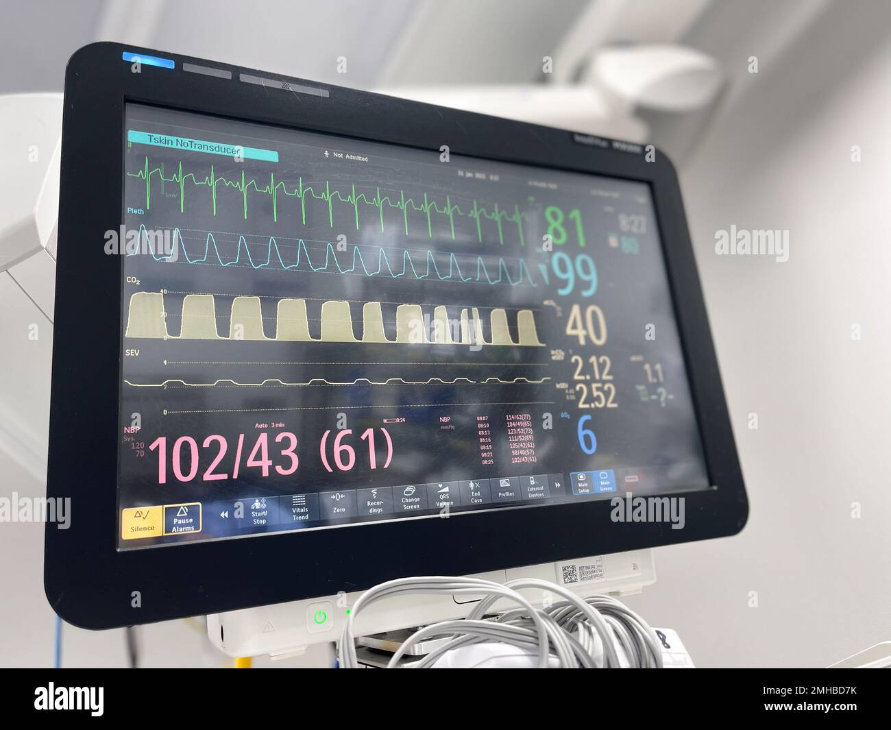 Hospital Monitors anesthesia machine blood pressure oxygen level heart ...