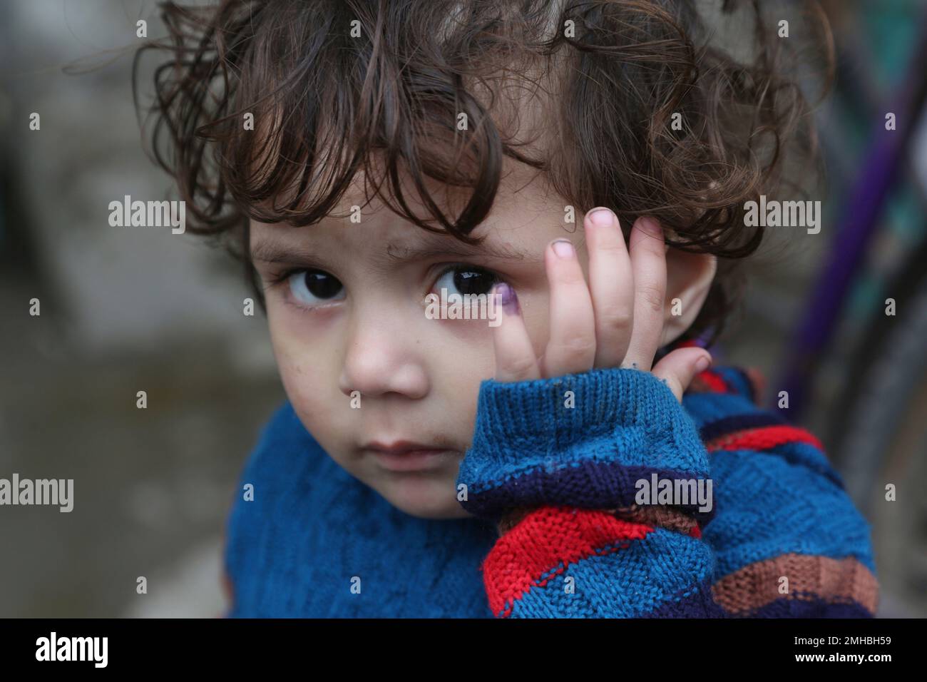 A girl show her ink-marked finger after having a polio vaccine in ...