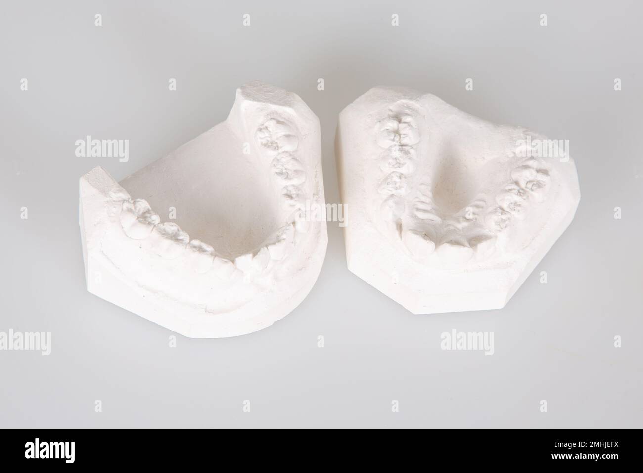Denture gypsum print plaster teeth model isolated on white background ...