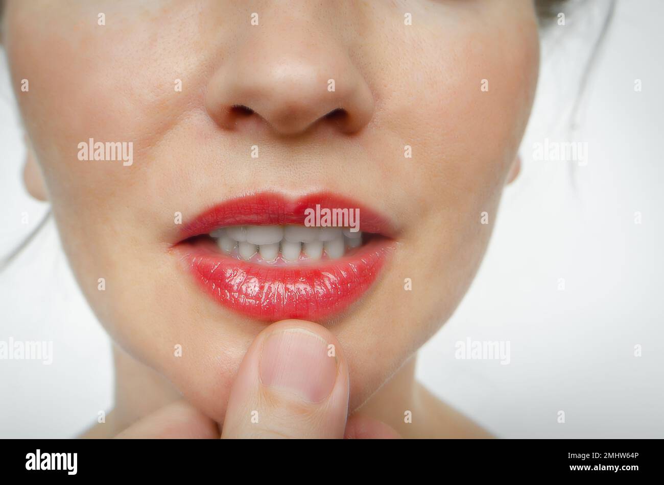 White teeth of woman. Dentistry. Treatment Stock Photo - Alamy
