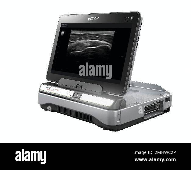 This image is released on Tuesday, Feb. 27, 2018. Hitachi Medical ...