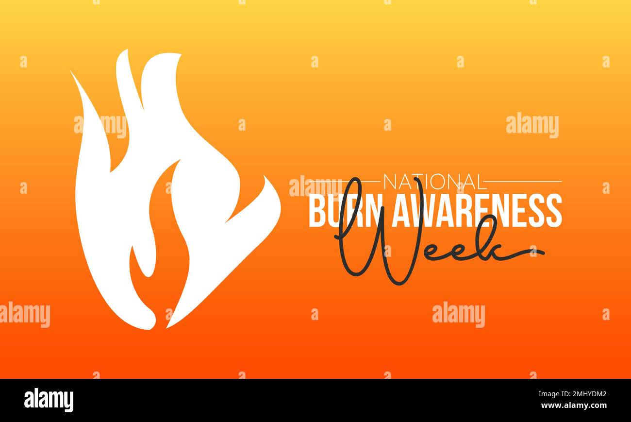 Vector illustration banner design template concept of Burn Awareness ...